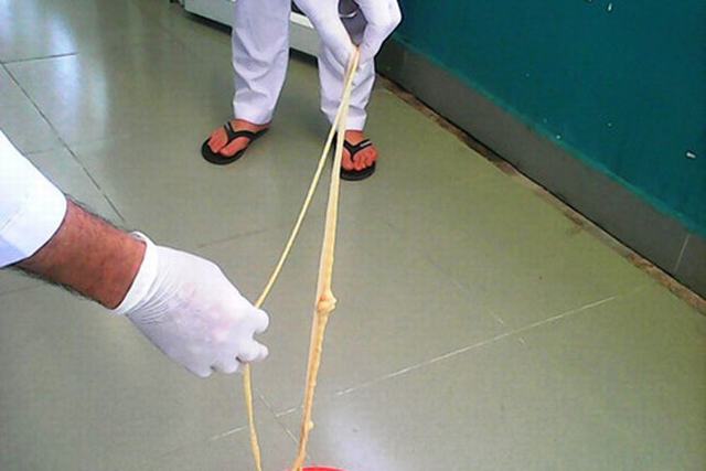 Các loại thuốc xổ sán xơ mít có tác dụng như thế nào